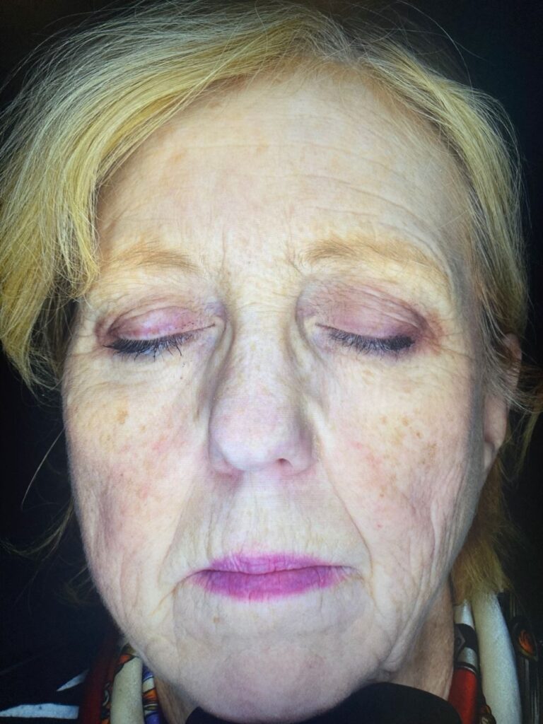 3D Face Scanning | Skin Solutions